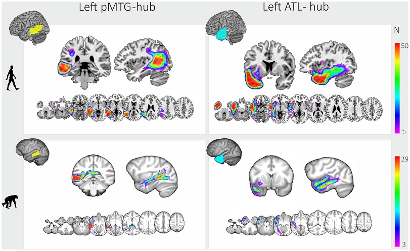 Comparing human and chimpanzee temporal lobe neuroanatomy reveals ...